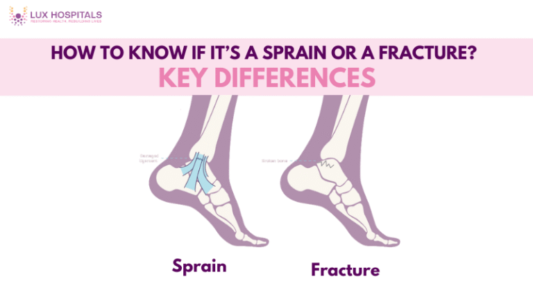 Sprain or Fracture? Key Differences, Symptoms, and Treatment